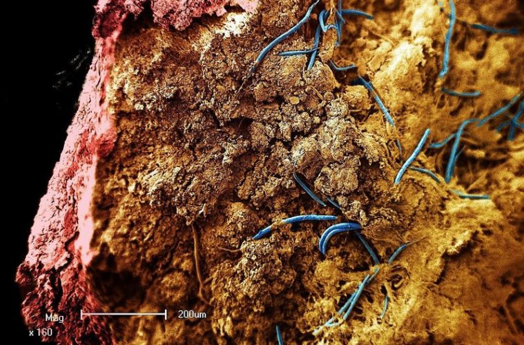 INNER EARTH IS TEEMING WITH LIFE: MULTICELLULAR ANIMALS DISCOVERED ...