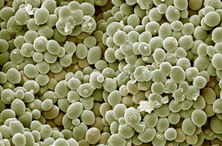 HOW NEW GENETICALLY ENGINEERED YEAST COULD CLEAN UP HEAVY METAL ...